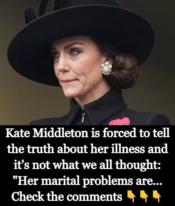 KATE MIDDLETON ADVISED TO TELL THE TRUTH ABOUT HER ILLNESS - unHeardFacts
